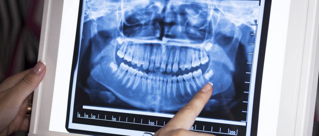 Clove Promise - Clove Dental