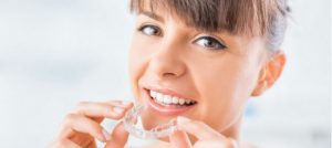 Aligners: How It Works For You?