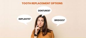 Your Ultimate Guide to Tooth Replacement Options: Implants and Dentures ...