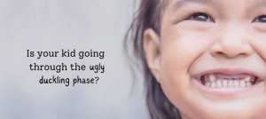 How To Take Care Of Your Child Teeth In Mixed Dentition Period