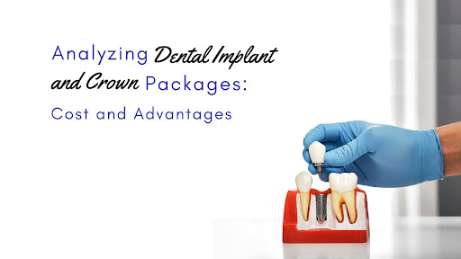 Exploring the Costs and Benefits of Dental Implant and Crown Packages