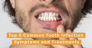 Top 5 Tooth Infection Symptoms & Treatments