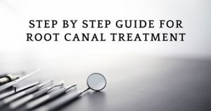 Step-by-step Guide to the Root Canal Procedure