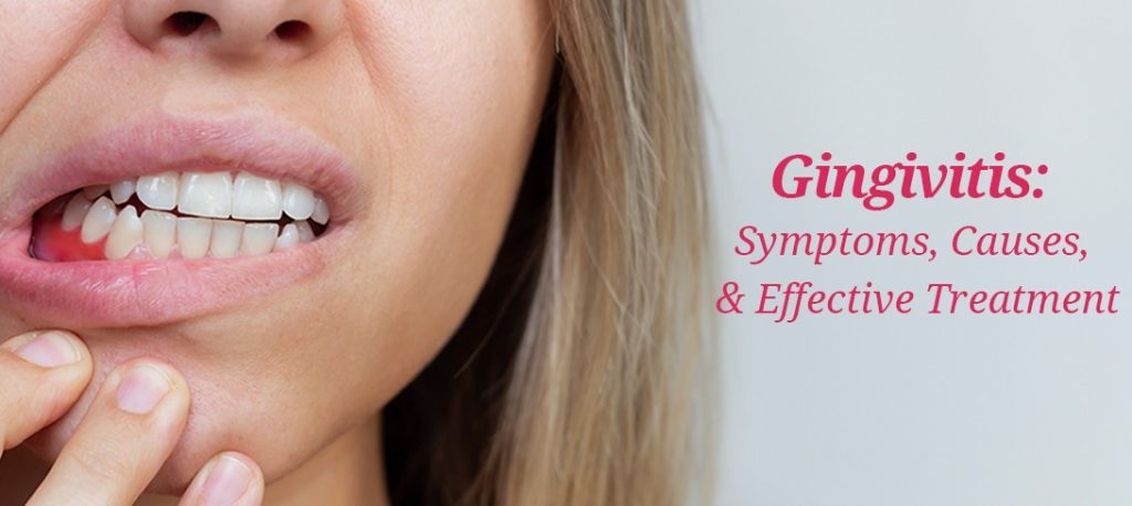 Gingivitis 101: How to Spot, Prevent, and Treat Gum Disease