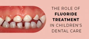 Fluoride in Kids Dental Care: Essential for Healthy Smiles