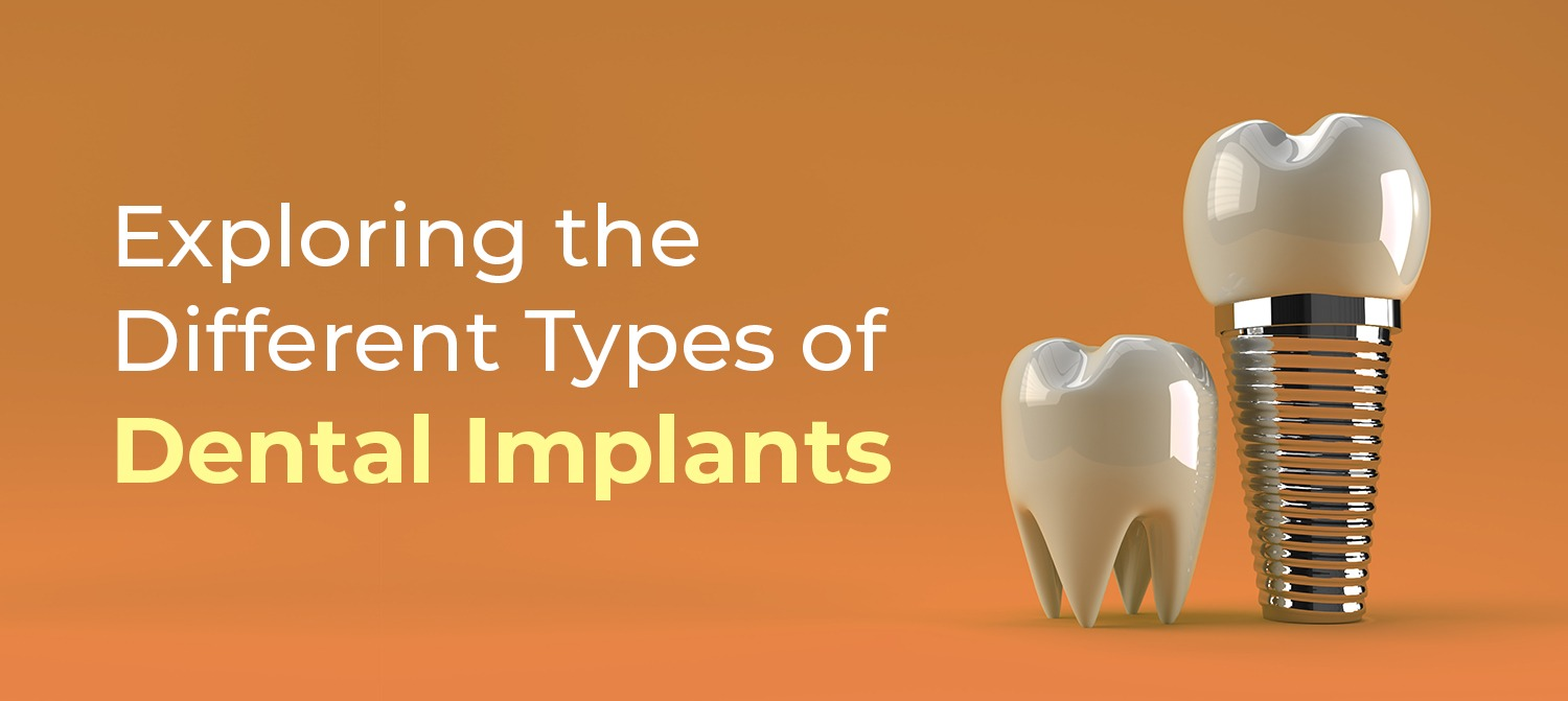 Types of Dental Implants