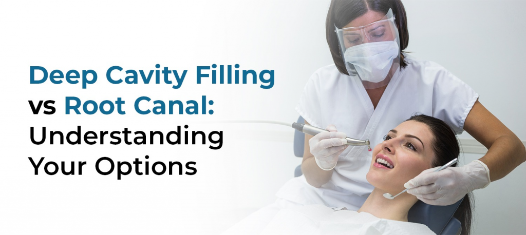 Deep Cavity Filling Vs. Root Canal Treatment