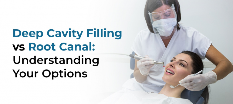 Deep Cavity Filling Vs. Root Canal Treatment