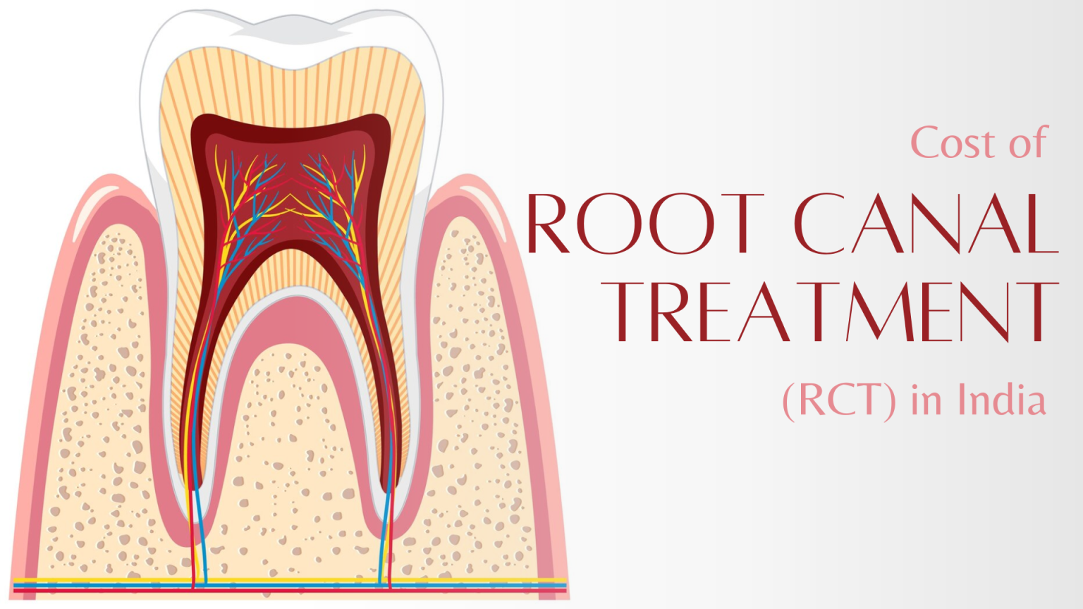 Deep Cavity Filling Vs. Root Canal Treatment